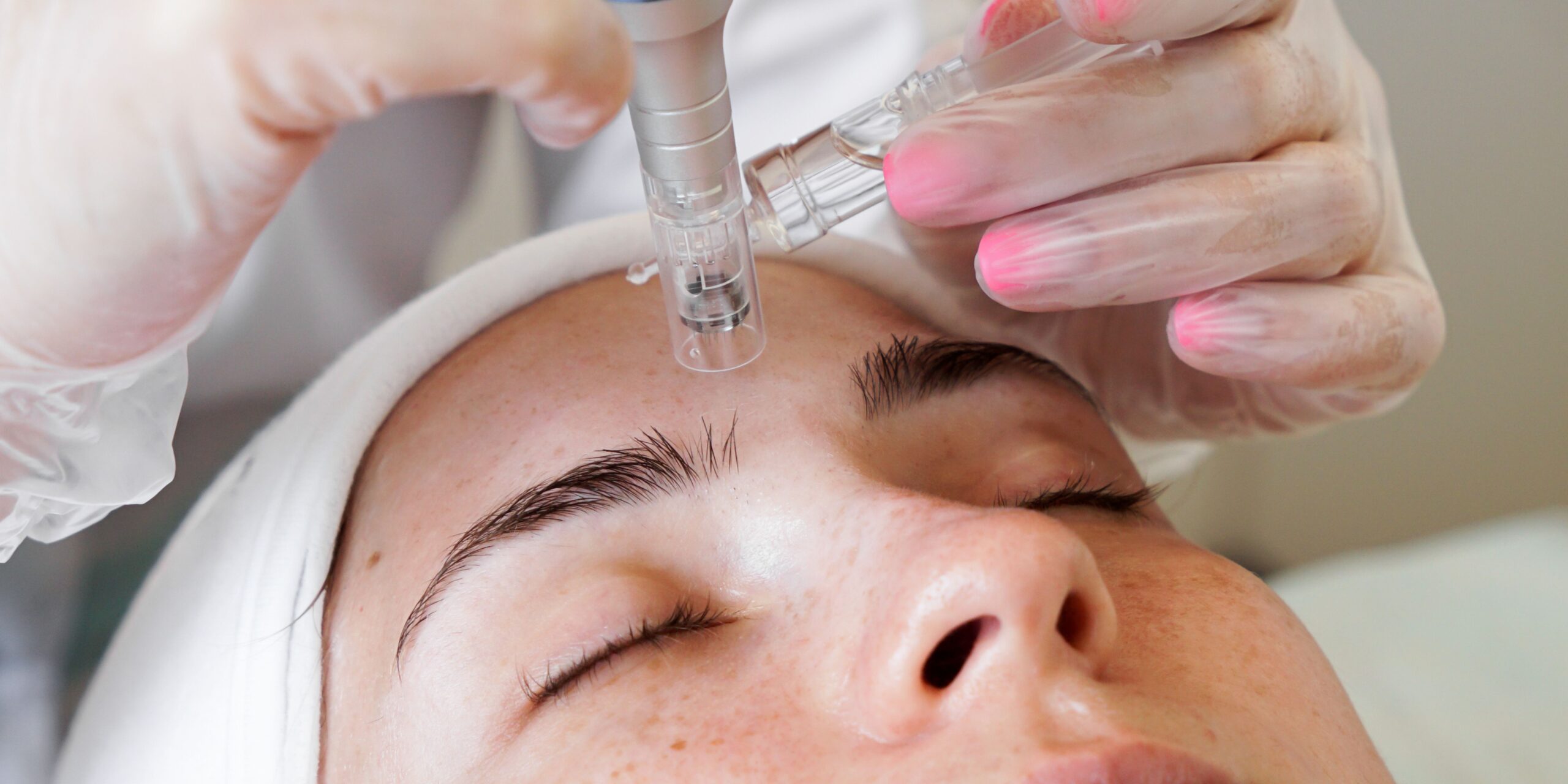 Best Microneedling in Vienna, VA - The Feisee Institute